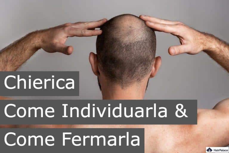 Chierica | Come Individuarla & Come Fermarla